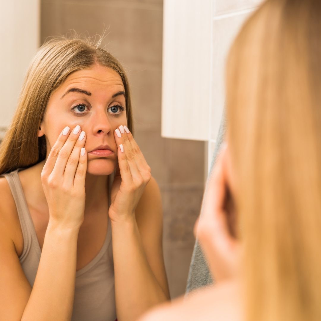 Bolsas y ojeras: SOLUCIONES NATURALES para sanar